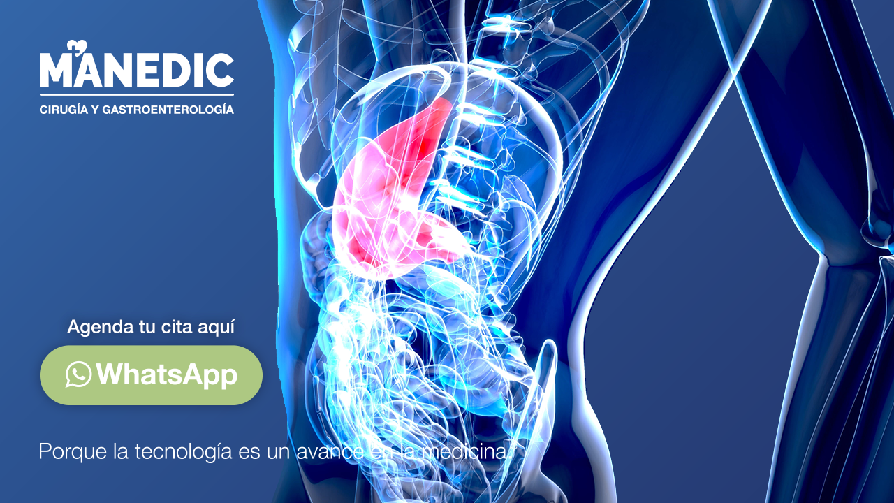 Colecistectomía - Manedic